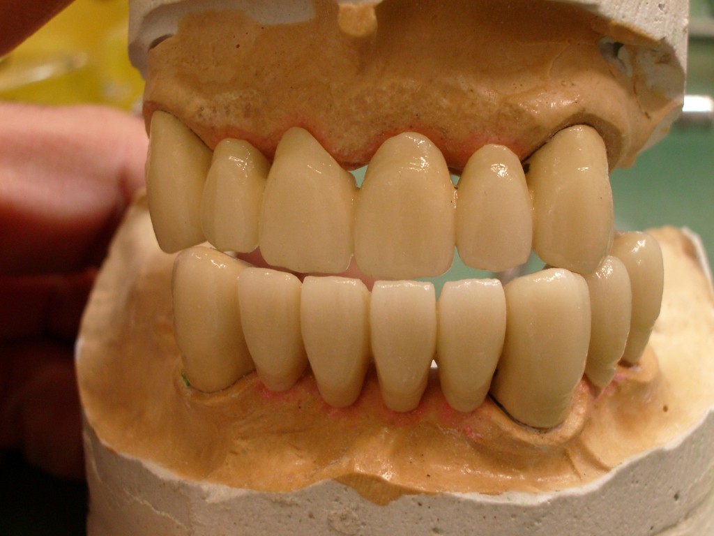 ΜΙΣΤΙΛΙΑΔΗΣ ΔΙΑΜΑΝΤΗΣ – ΟΔΟΝΤΟΤΕΧΝΙΚΟ ΕΡΓΑΣΤΗΡΙΟ